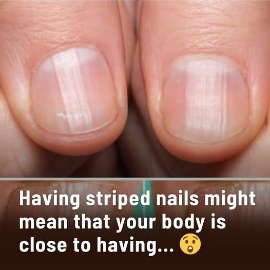 Understanding the Real Causes of Vertical Ridges on Your Nails – Best ...